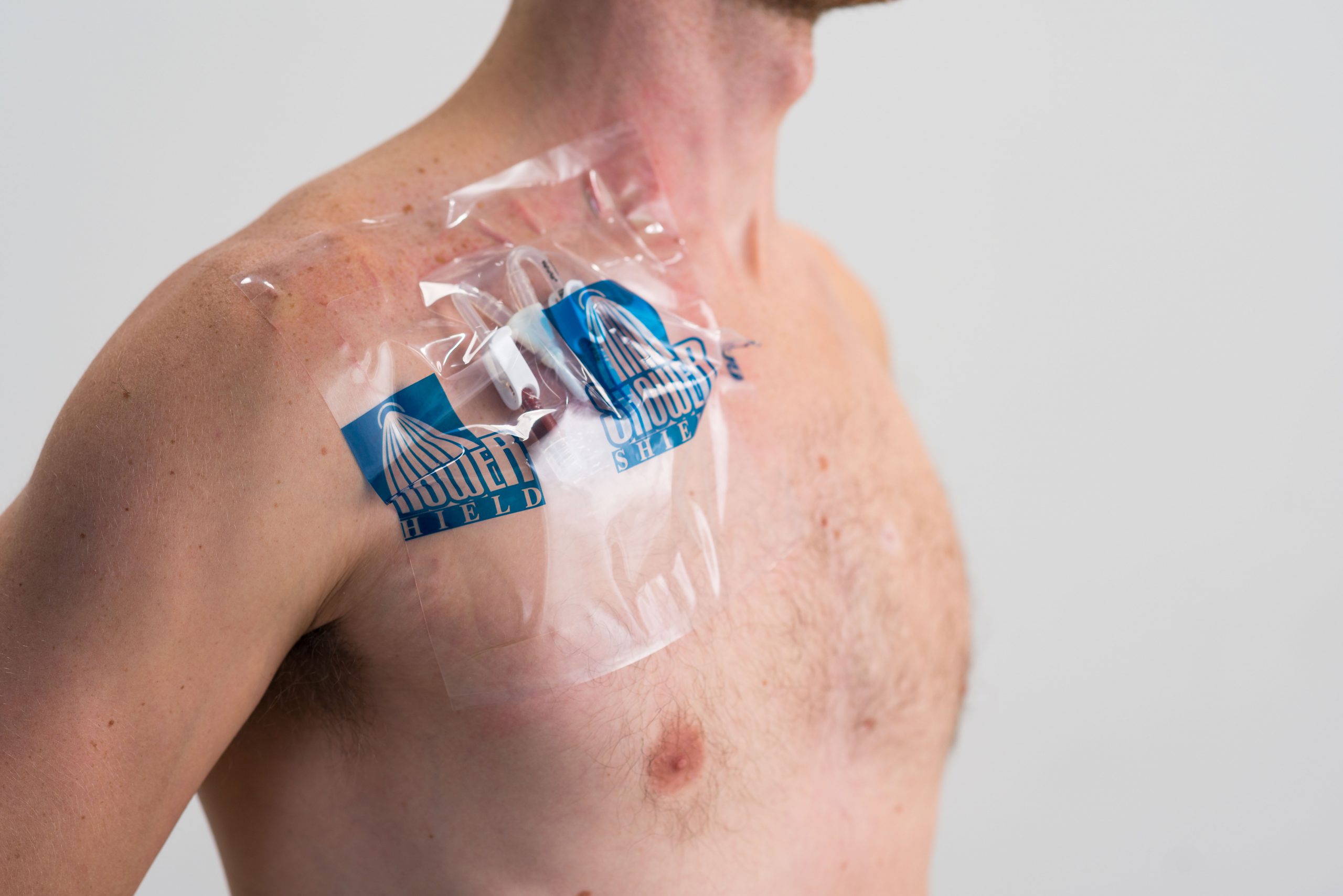 9X9 Wound & Catheter Cover